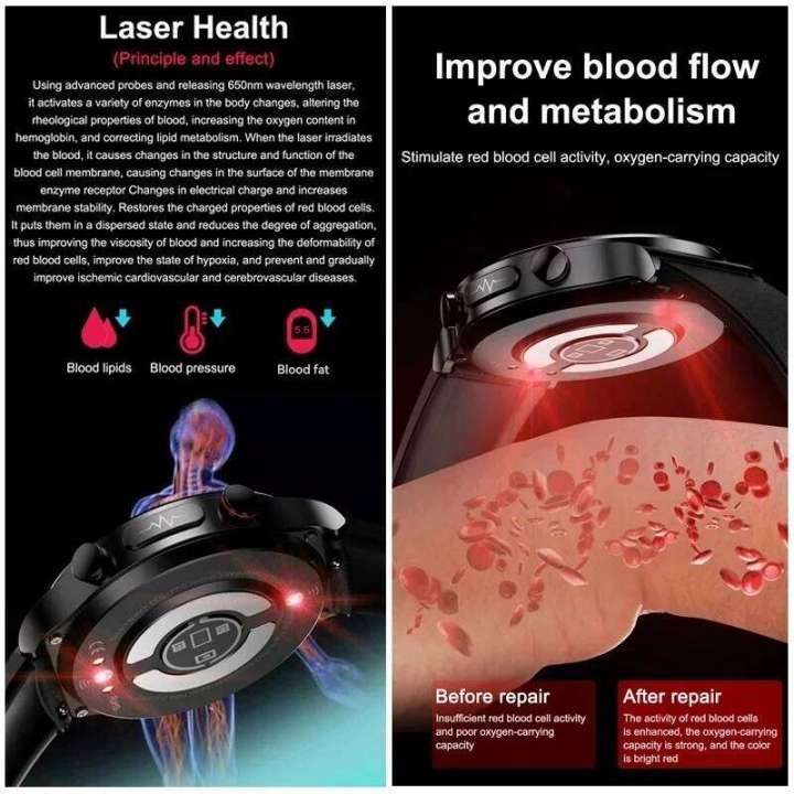 New Laser therapy Uric acid lipid Smart Watch Men Women ECG+PPG Blood ...