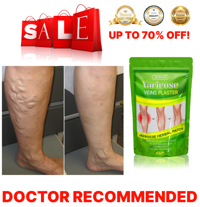🔥BEST SELLER🔥 ORIGINAL SHIRAKI VARICOSE PLASTER 25 PCS | Varicose Veins ...