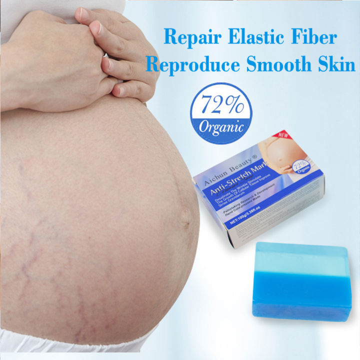 【Pengiriman rahasia】Aichun Beauty Anti-Stretch Mark HANDMADE SOAP ...