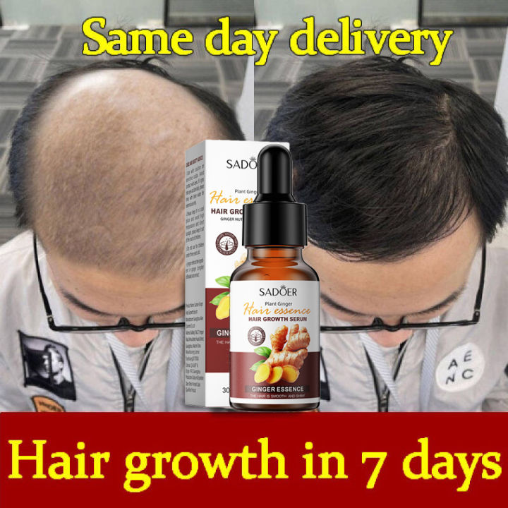 serum penumbuh rambut penumbuh rambut cepat serum rambut perontok hair ...