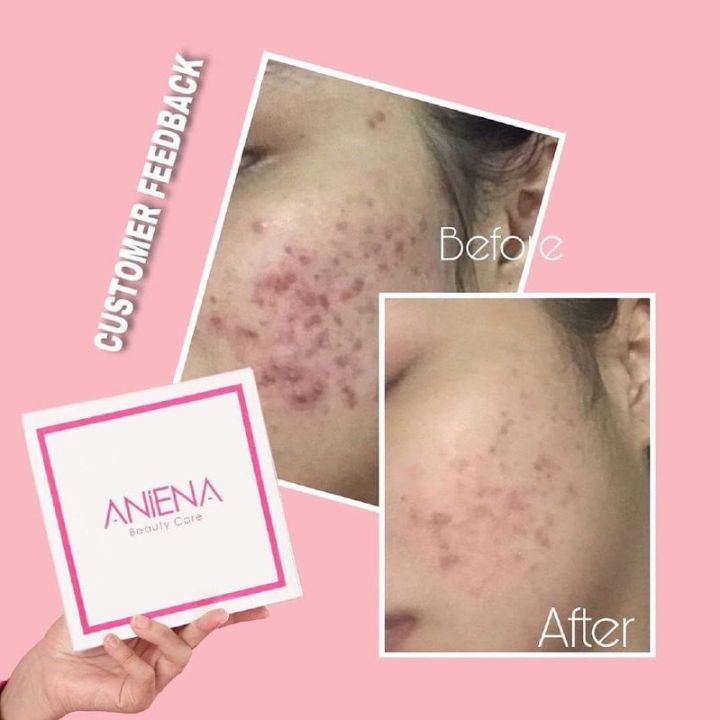 ANIENA SKINCARE ORIGINAL HQ | Lazada