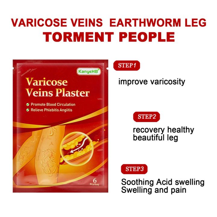 6pcs/12pcs/18pcs/24pcs Varicose vein patch pain relief body relief knee ...