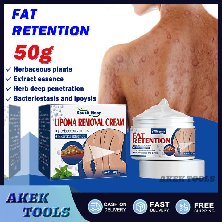 50G Lipoma Removal Cream Lipolysis Fat Lump Relief Plaster Anti-Tumor ...