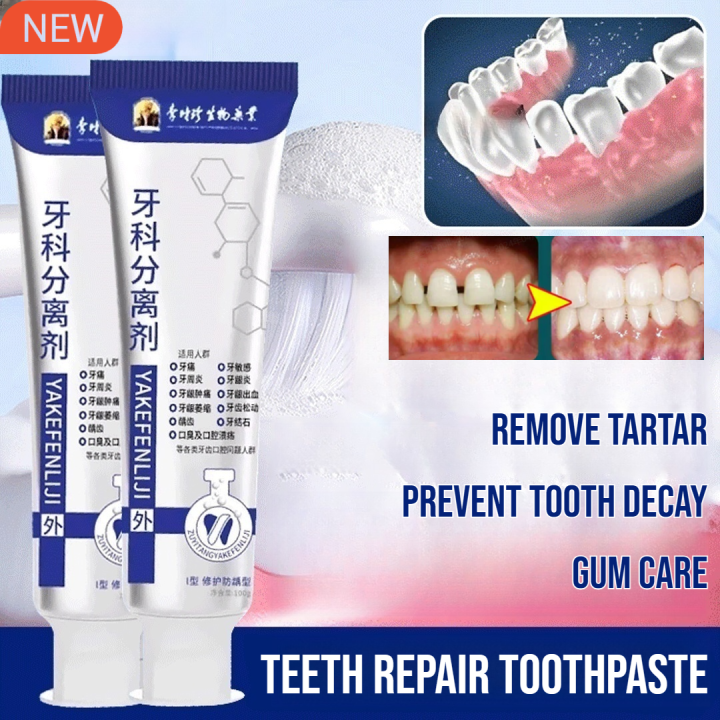 [Dental Specialty] Teeth Repair Toothpaste Remove Tartar Yellow Teeth ...