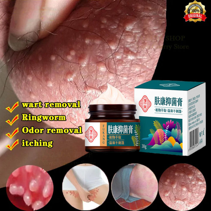 Official Authentic Itching Cream Krim Gatal Psoriasis Eczema Cream