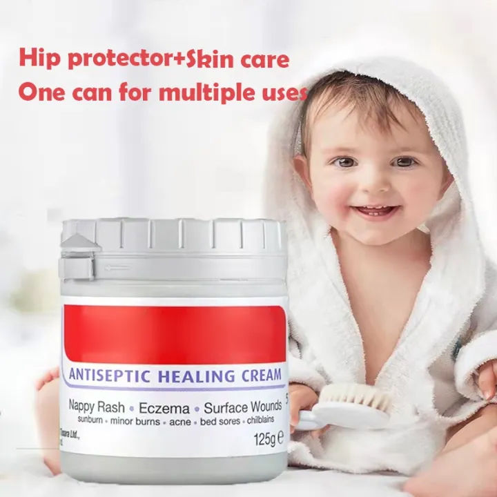 Antiseptic Healing Cream Nappy Rash Cream Eczema Surface Wounds Sunburn ...