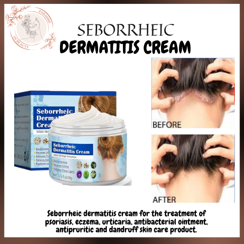Seborrheic Dermatitis Cream Psoriasis Cream Itching Cream for Eczema ...