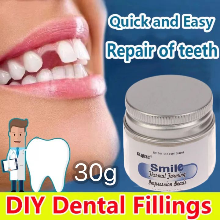 Lem Gigi Palsu Temptooth Penambal Gigi Isi,Temporary Tooth Repair 30g ...