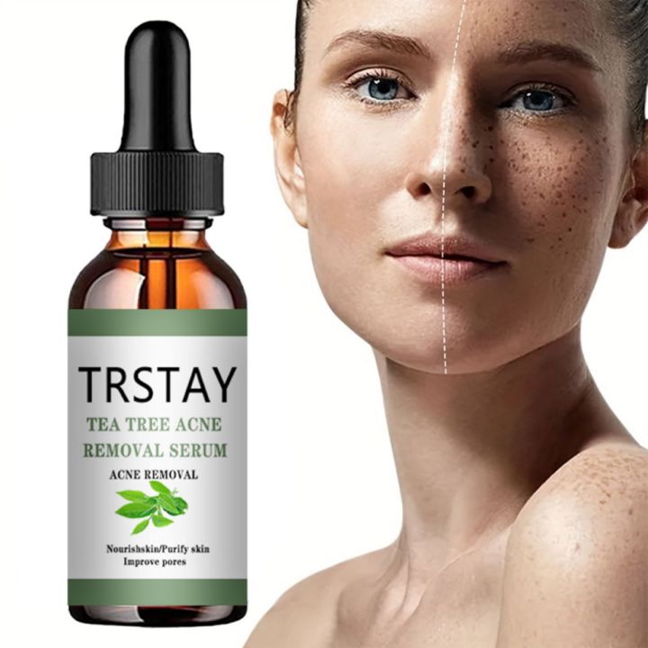 Acne Treatment Face Serum Tea Tree Oil Essence Moisturizing Shrink ...