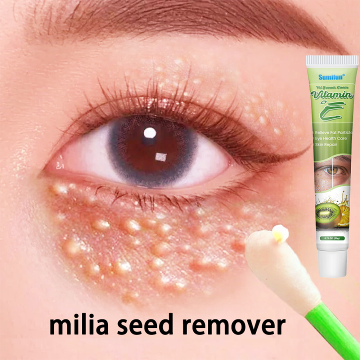 milia seed remover cream milia remover Eye Cream Syringoma 汗管瘤脂肪粒 Fat ...