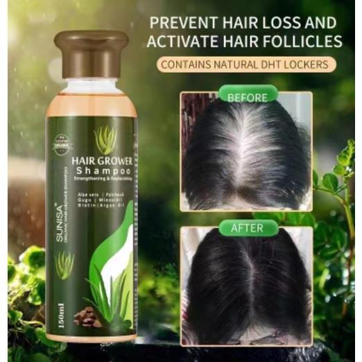 Extreme Aloe Vera Hair Grower Shampoo Anti Loss | Lazada PH