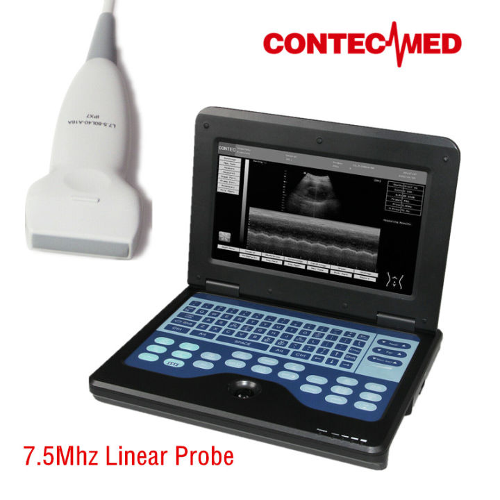 ContecMed CMS600P2 Human version Ultrasound scanner laptop machine 10.1 ...
