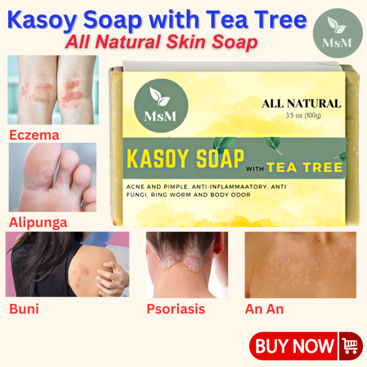 MsM Kasoy Soap Original with Tea Tree |Sabon sa Kati kati sa Balat ng ...