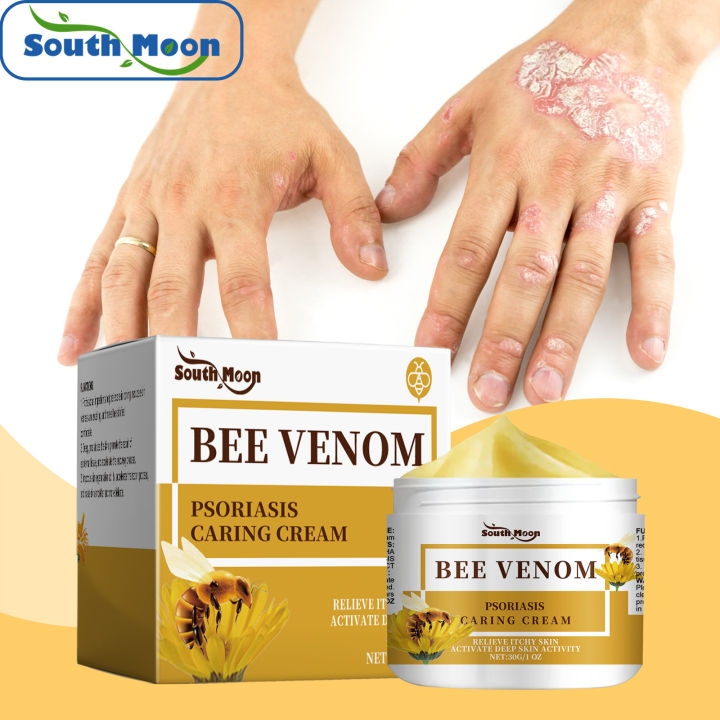 South Moon Bee Venom Psoriasis Caring Cream Treatment Eczema Dermatitis ...