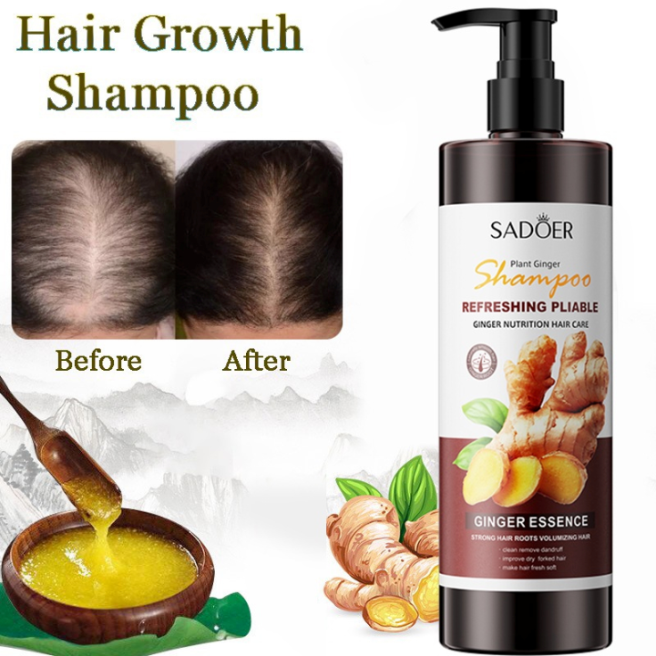 Sadoer Ginger Shampoo And Conditioner 500ml Anti Hairfall And Hair Growth