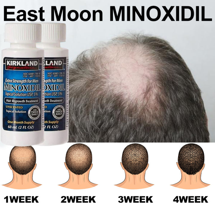 Minoxidil Hair Grower Original Hair Grower For Man And Woman Hair