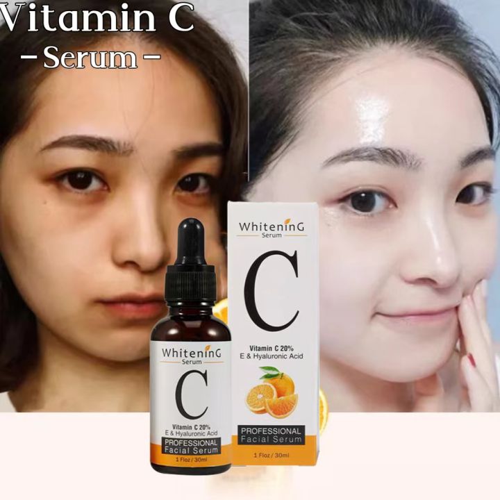 Original Face Whitening Serum Vitamin C Serum Acne Care Radiance