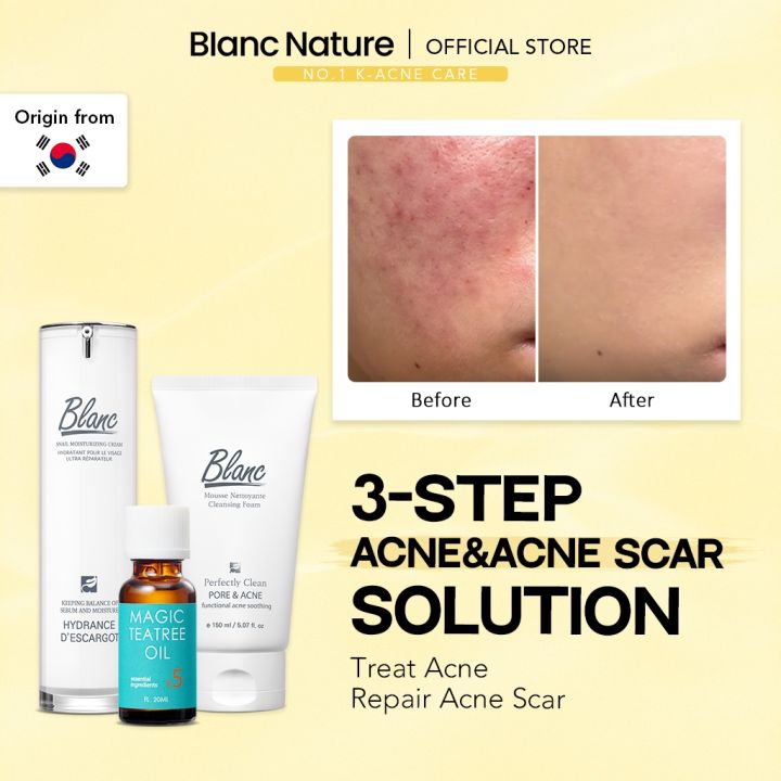 [ Blanc Nature ] 3 Step Acne&Acne Scar Solution ( Instant Acne Spot ...