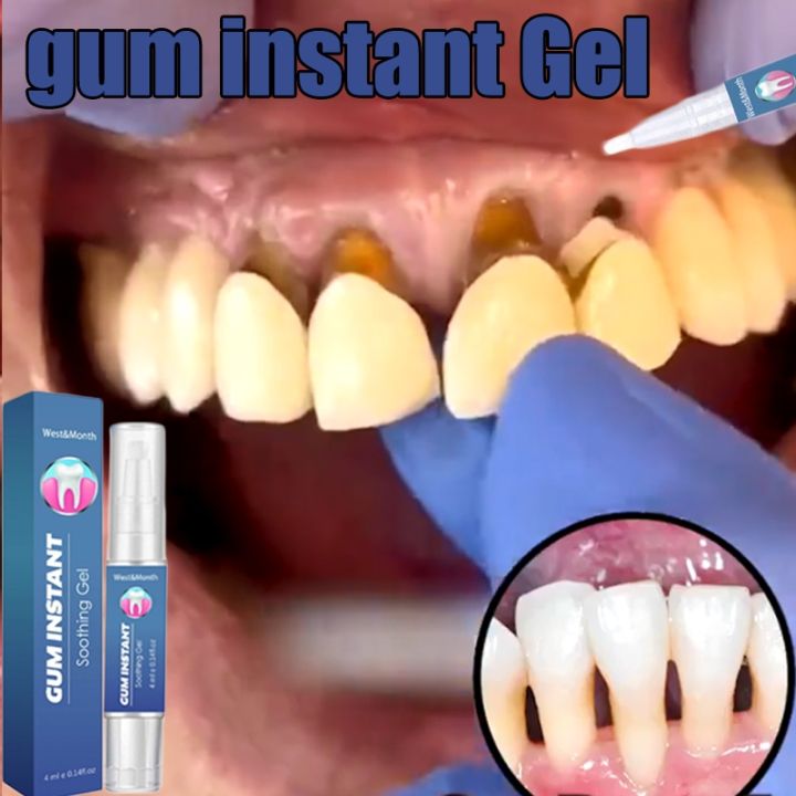 Gum Instant Soothing Gel Receding Gums Therapy Inflammation Treatment