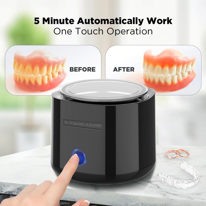 Ultrasonic Cleaner Retainer Cleaning Machine: 42kHz Ultra Sonic Denture ...