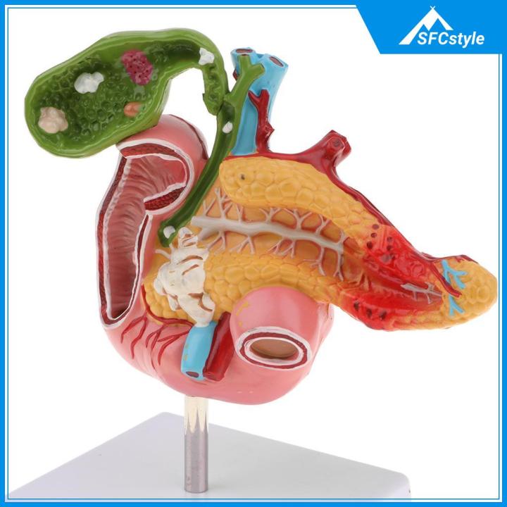SFCstyle Human Pancreas Duodenum Gallbladder Model, on Stand, Lab ...