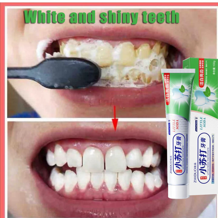 Toothpaste Care Oral Fresh Tooth Stain Removal Cross-Border Foreign ...