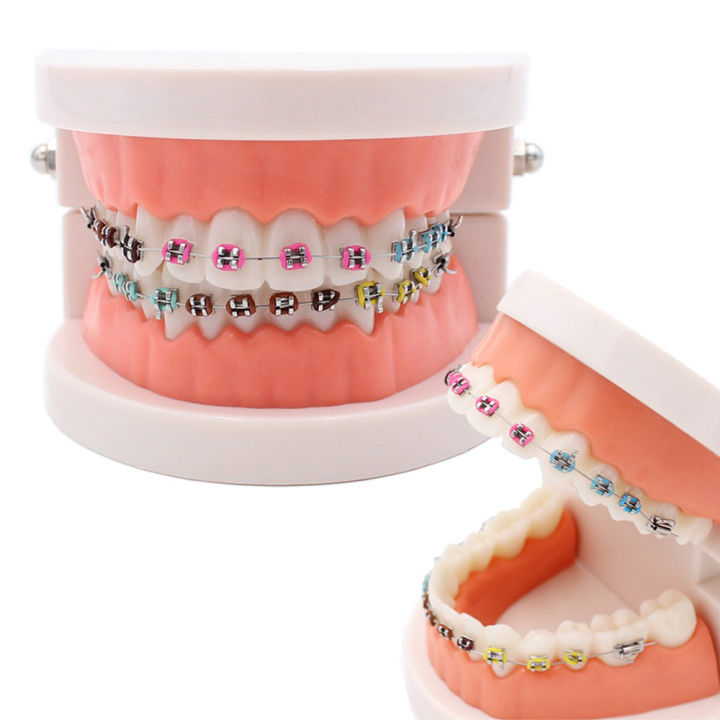 Dental Treatment Model with Ortho Metal Ceramic Bracket Arch Wire ...