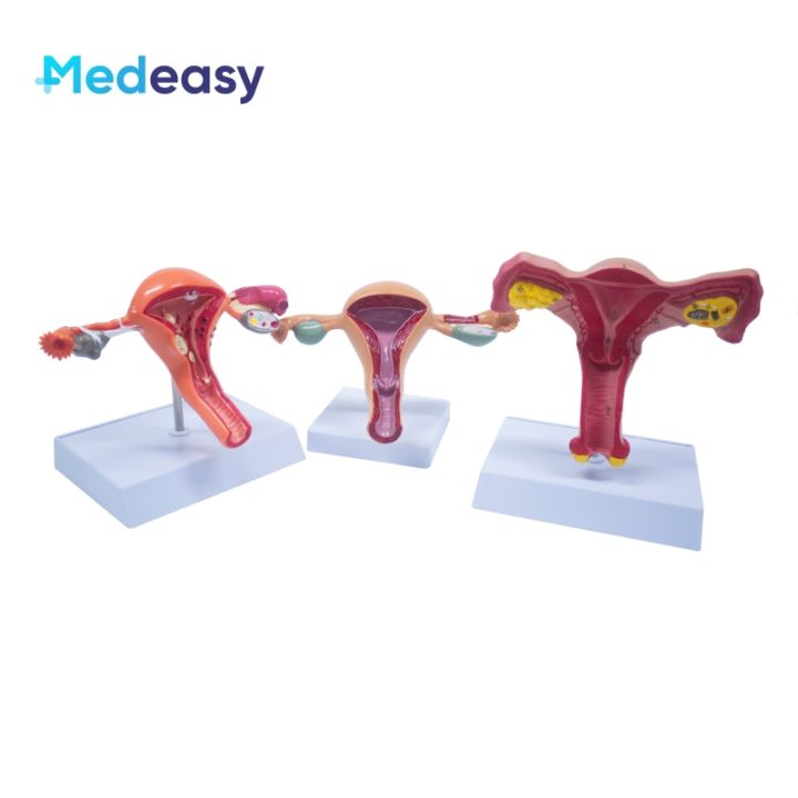 【Bestselling Product】 Female Uterus And Ovary Anatomical Model Model ...