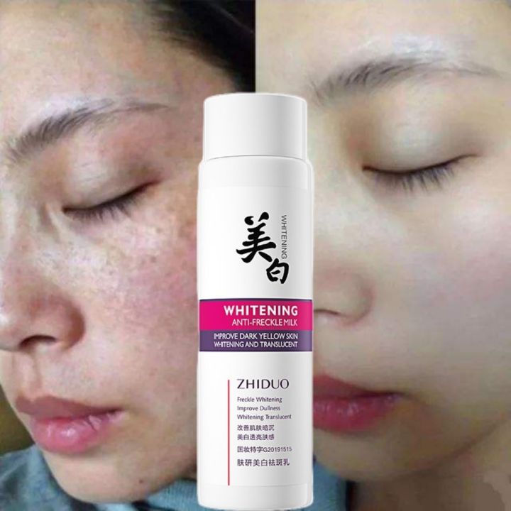Whitening Freckle Cream Ultimate Pekas Cream 3-5days goodbye sumpa kana ...