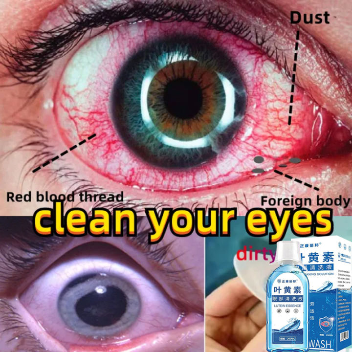 260ml Medical Eyes Wash Solution For Soothes Eyes & 15ml Eye Drops For ...