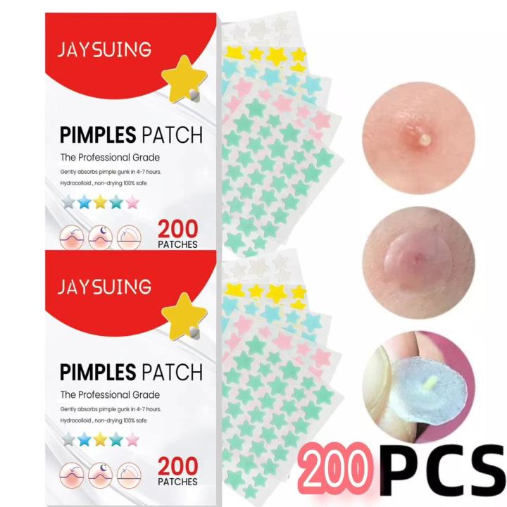200PCS Acne Pimple Patch Waterproof Hydrocolloid Pimple Stickers ...