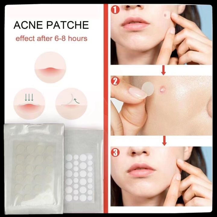 【COD】36pcs/sheet Acne Pimple Patch Salicylic Acid Acne Treatment ...