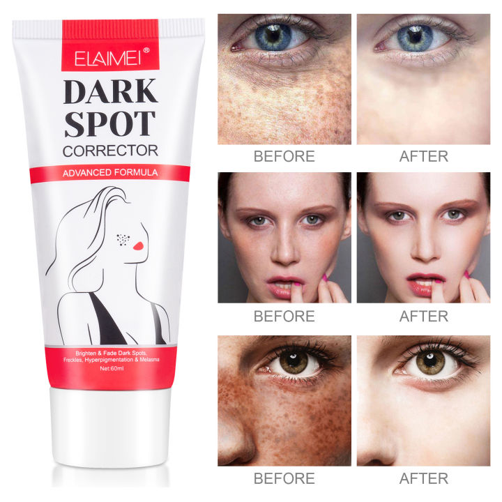 Pekas Remover Effective Melasma Cream Anti Freckle Collagen Original ...