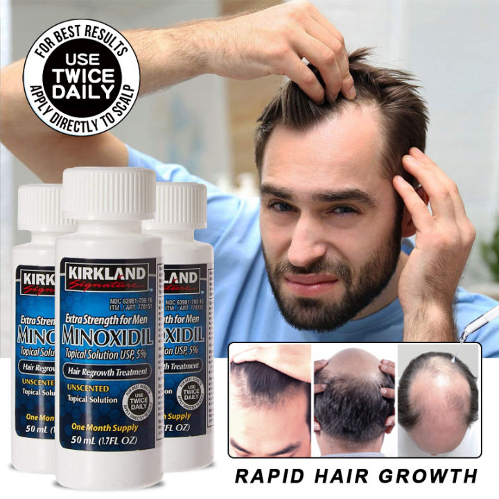 Mi No Xi Dil 5 Topical Solution Usp Activates Hair Follicles For Men