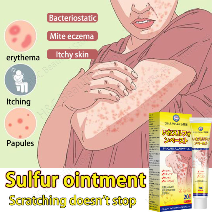 Sulfur creamcream eczema cream Antibacterial and anti-inflammatory Acne ...