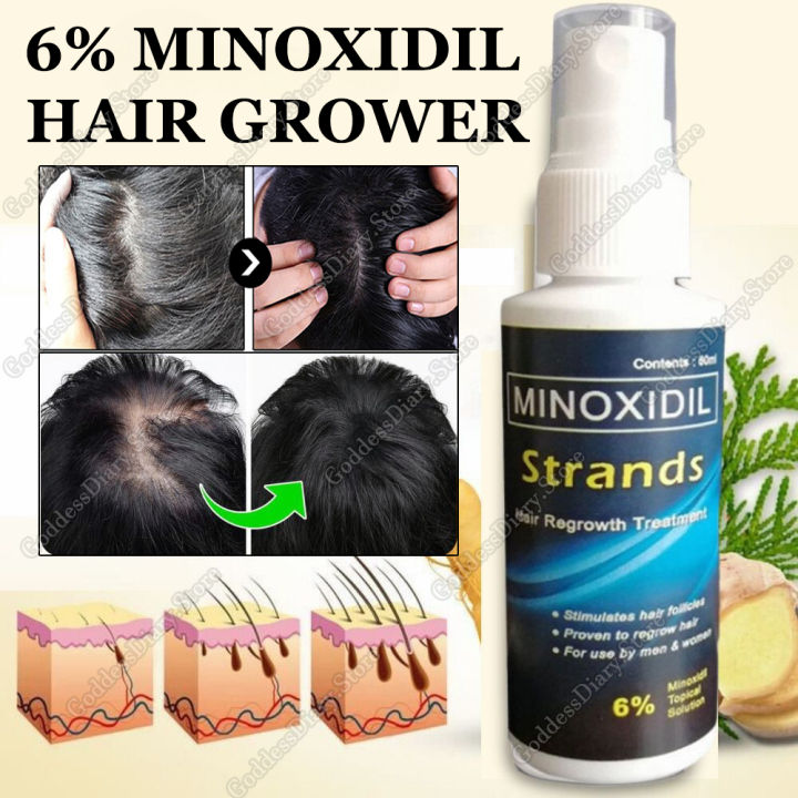Strands MINOXIDIL 6% Topical Solution Hair Grower Beard Growth Anti ...