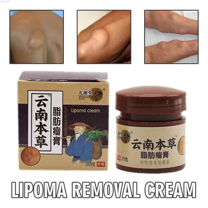 FAST EFFECT!! 20g Lipoma Removal Cream Original Natural Chinese Herbal ...