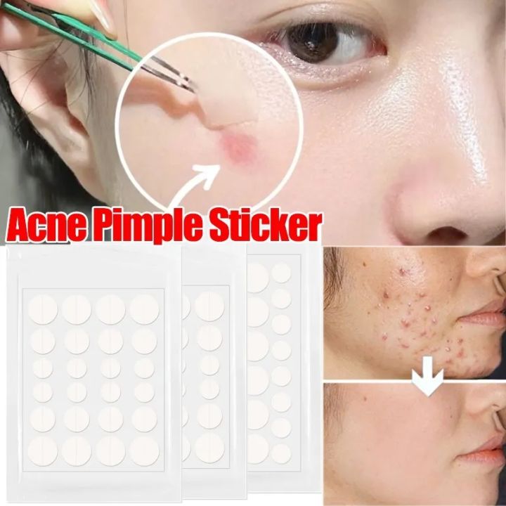 24/36Pcs Hydrocolloid Acne Invisible Pimple Master Patch Skin Tag ...
