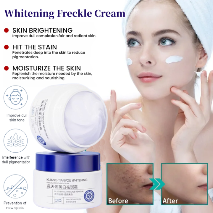 Effective Whitening Freckle Cream Moisturizing Facial Spot Cream ...