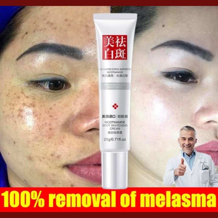 Dark spot remover for face melasma and pekas remover original melasma ...