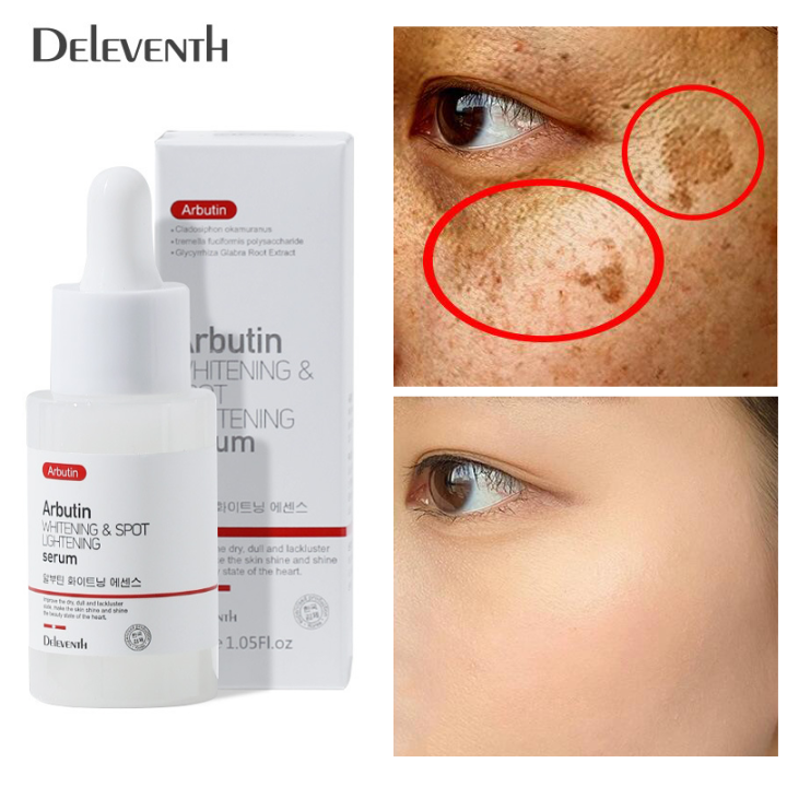 【Ready Stock】Arbutin Whitening Face Serum Fade Dark Spots Freckle Remove Melasma Melanin Essence ...