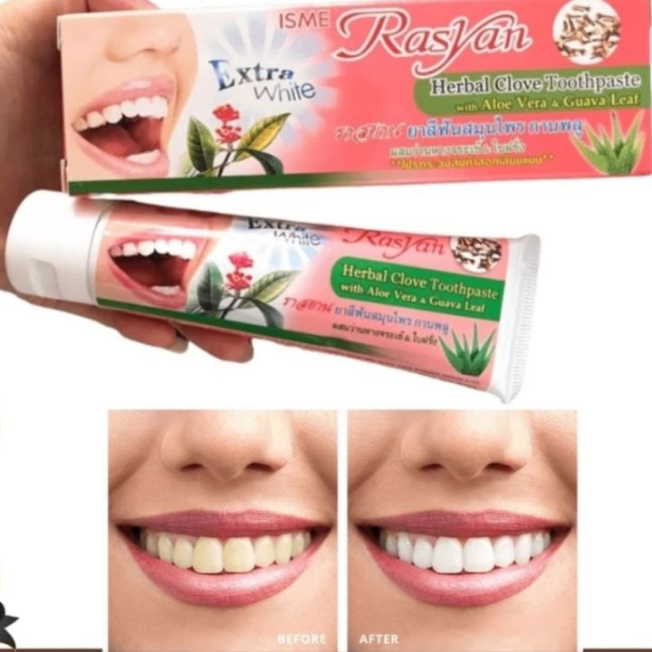 Rasyan Herbal Clove Toothpaste 100g | Lazada PH