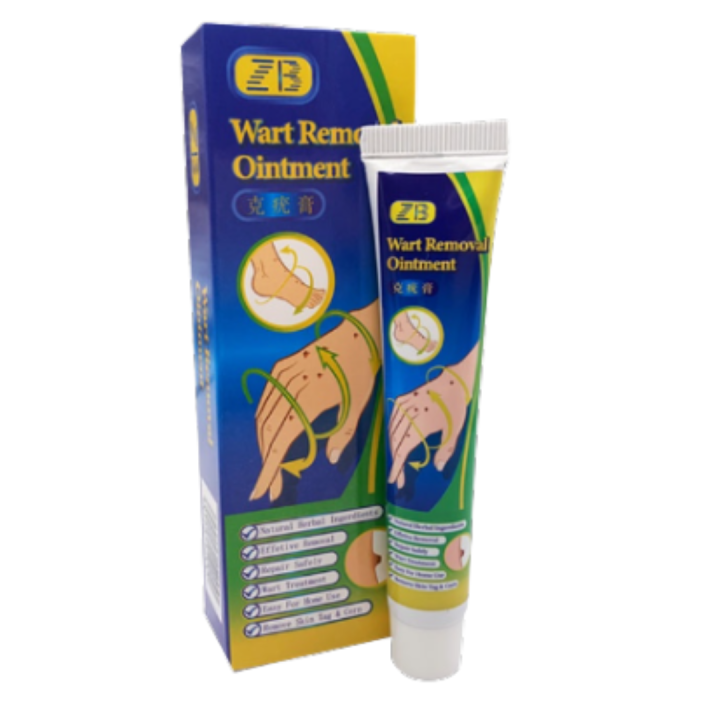 Warts Remover Cream Painless Wart Removal Cream Kulugo Removal Ointment ...