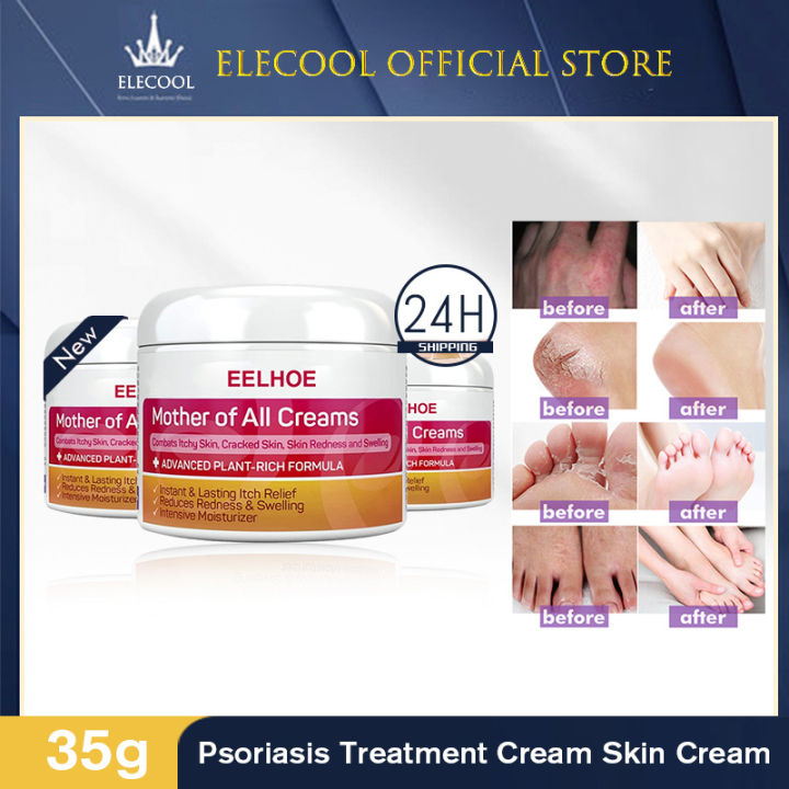 1PC Ointment Treatment Non-greasy Texture Clinically Proven Dermatitis ...