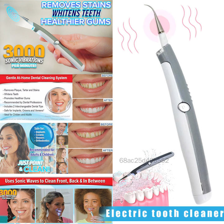 JoyPretty Electric Ultrasonic Tooth Stain Plaque Remover Tool Teeth ...