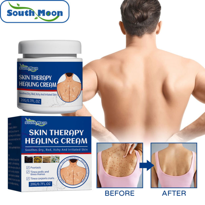 South Moon Skin Therapy Healing Cream Skin Antipruritic Cream Itch