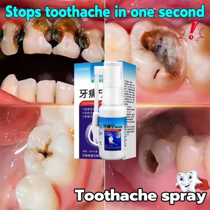 Toothache insect repellent spray Toothache Spray 20ML quickly relieve ...