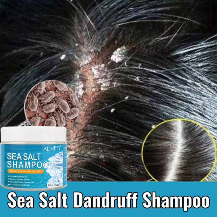 ALIVER Sea Salt Anti Dandruff Shampoo Hair Treatment 200g Anti-Dandruff ...