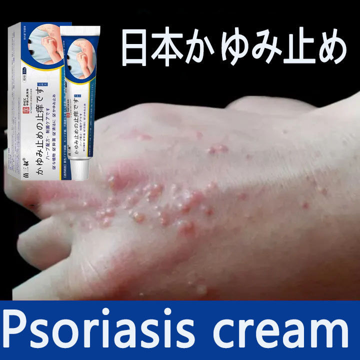 Japan Herb Herbal Medicine Psoriasis Eczema Ointment Dermatitis Vitiligo Skin Rash Cream 20g ...