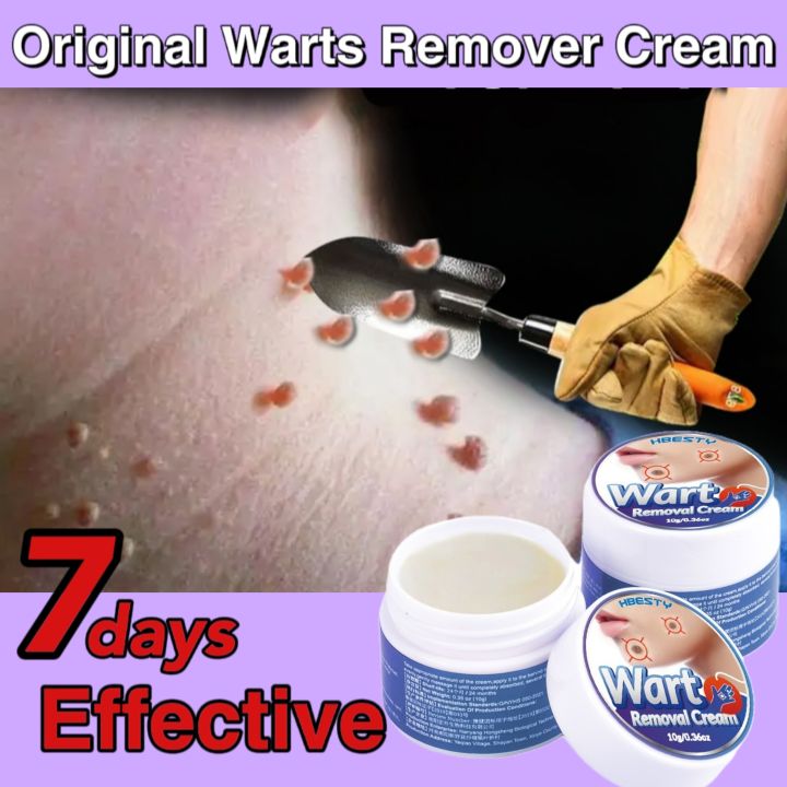Warts remover original Cream kasoy oil cream Kulugo mole skin tag Wart ...